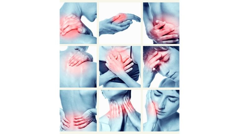 What are the 4 stages of fibromyalgia? - ANF