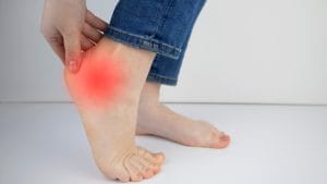 Bursitis or Tendonitis? Here’s the Real Reason Your Heel Hurts - ANF
