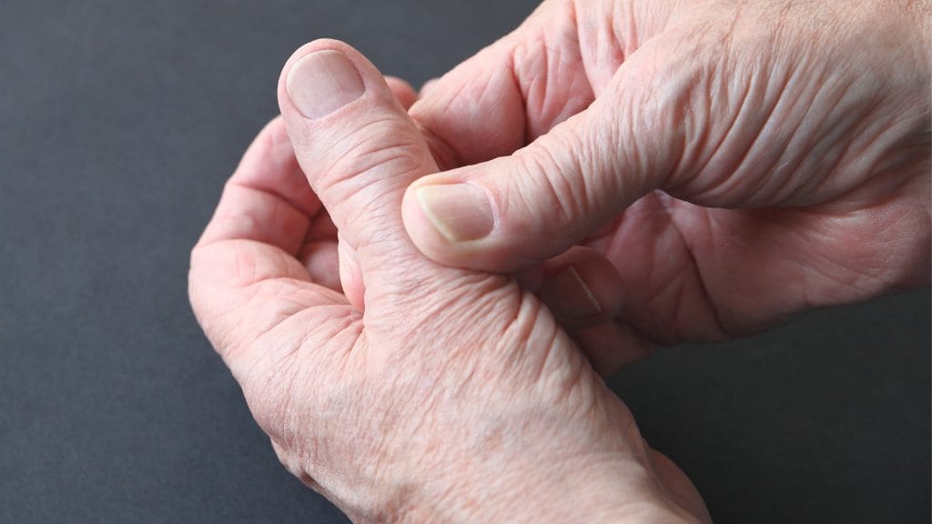 Thumb Ulnar Collateral Ligament Injury: Causes, Symptoms, Diagnosis ...